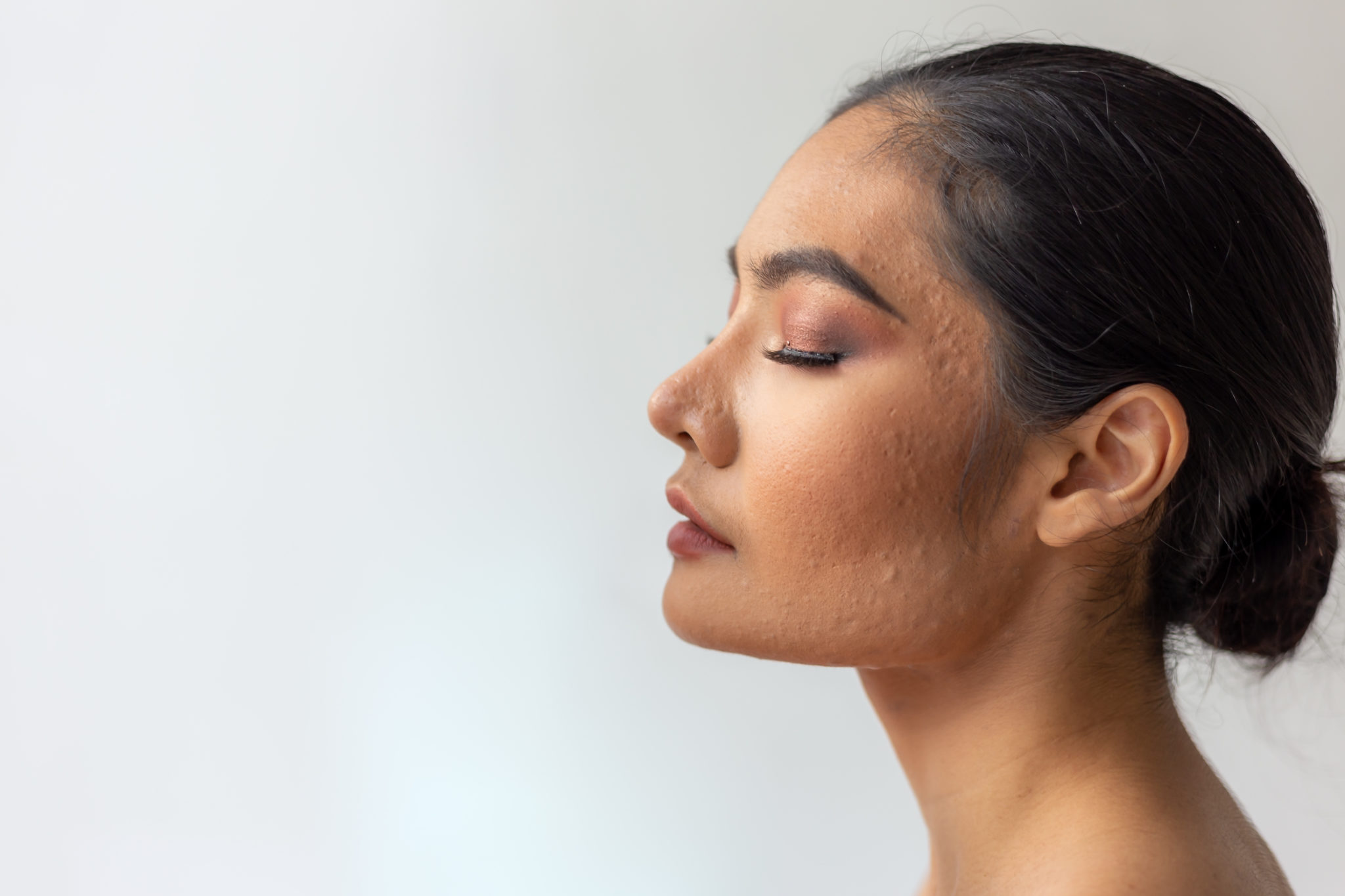 Beautiful asian woman has facial skin problems. Charming beautif ...